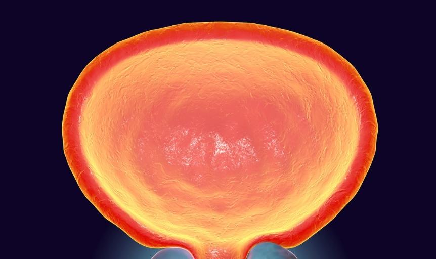 What is Rezum? How is Rezum Treatment Applied?